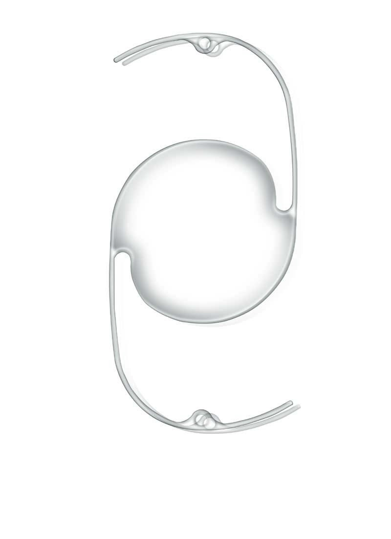 Rigid Polymethyl Methacrylate (PMMA) Scleral Fixation Of Intraocular ...